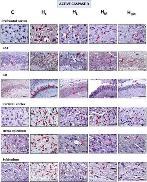 Apoptotic Cells Evaluated By Active Caspase 3 In Prefrontal Cortex Download Scientific Diagram