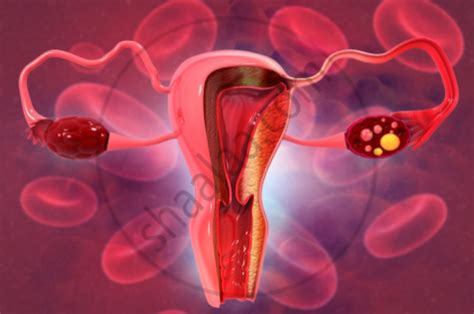Sexually Transmitted Diseases STD Shaalaa Com