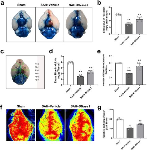 Administration Of Dnase I Attenuated Csf Flow Disorder And Improved