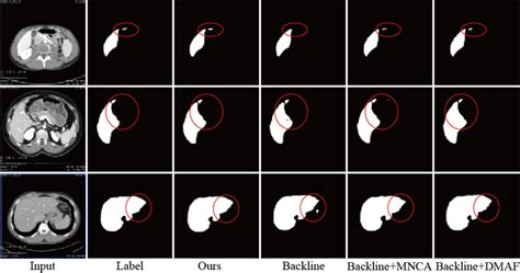 Dmagnet Dual‐path Multi‐scale Attention Guided Network For Medical Image Segmentation Ji