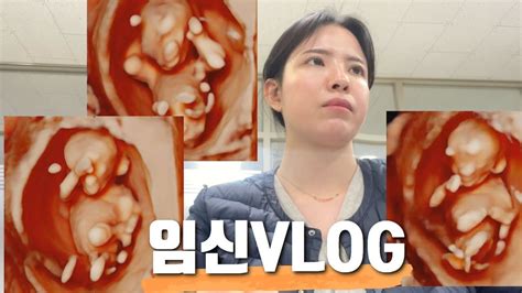 임신vlog10주부터 12주까지임산부 일상임산부 브이로그1차 기형아검사 무사히 통과첫 입체초음파직장인 임산부