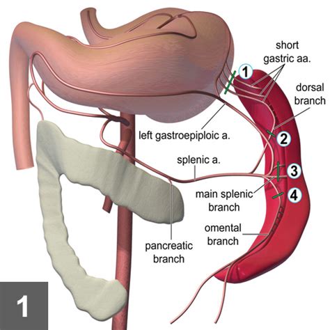 Total Splenectomy Clinicians Brief