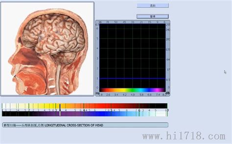 升级版9d检测仪，金龙版9dnls亚健康检测仪价格 超声波探伤仪 维库仪器仪表网