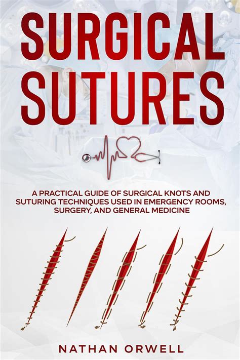 Sutures Ligatures And Knots At Timothy Jeffords Blog