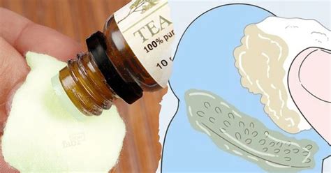 Pearly Penile Papules No More Tea Tree Oil Method For Treating Pearly