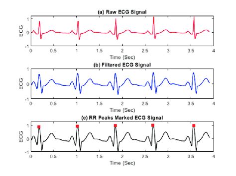 A Raw Ecg Waveform B Filtered Ecg Waveform With Baseline
