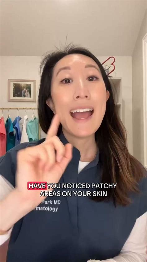 Atrophic Tinea Versicolor Causes Treatments And Easy Fixes Video