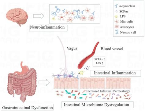 The Role Of The Microbiota Gut Brain Axis And Intestinal Microbiome Dysregulation In Parkinsons