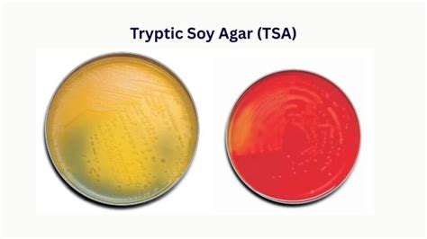 Tryptic Soy Agar Principle Composition Examples And Uses