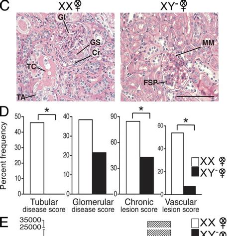 the xx sex chromosome complement as compared with the xy⁻ confers