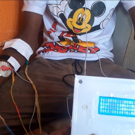 Non Invasive Glucose And Ecg Levels Monitoring Arduino Smartech