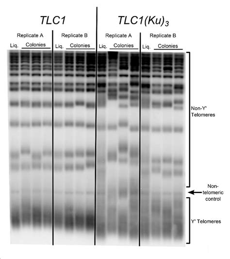 Figure Supplement 1 Three Ku Binding Sites In Yeast Telomerase Rna Download Scientific Diagram
