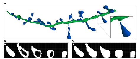 Figure 3 From A Deep Learning Based Workflow For Dendritic Spine Segmentation Semantic Scholar