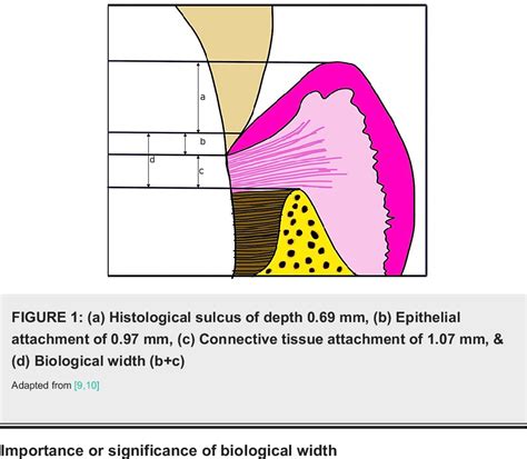 Figure 1 From Exploring The Biological Width In Dentistry A