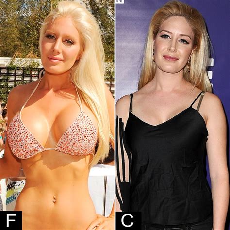 Before And After Plastic Surgery Breast Reduction