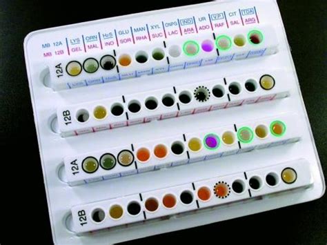 Identification Of Clinically Significant Micro Organisms Scientist Live