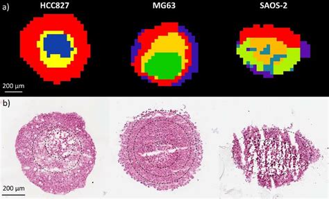 Spatial Segmentation Of A Hcc827 Mg63 And Saos 2 Aggregoid From Download Scientific Diagram