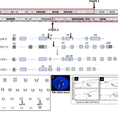 Genomic Browser Image With Exon Map Showing Different Pml Rara Isoforms Download Scientific