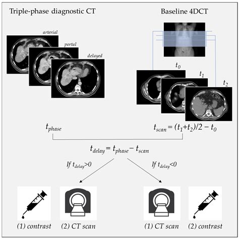 Synchronized Contrast Enhanced 4dct Simulation For Target Volume