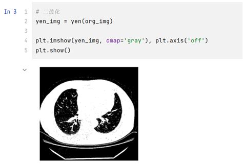 【cv作业05】肺部区域提取 ct 肺部轮廓提取 github csdn博客
