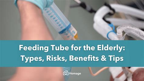 Feeding Tube For The Elderly Types Risks Benefits And Tips Homage Malaysia