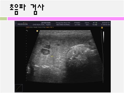강아지 비장 종양