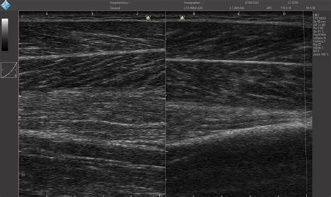 Telemed Ultrasound Home Telemed Ultrasound Home