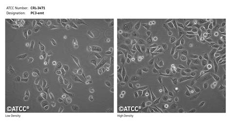 Pc3 Emt Crl 3471 Atcc