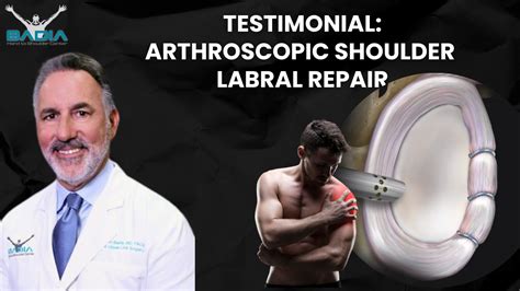 Patient Testimonials Shoulder Labrum Tears