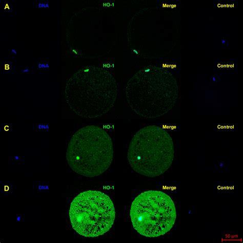 Localization Of Ho 1 In Meiotically Matured Porcine Oocytes Mii A Download Scientific