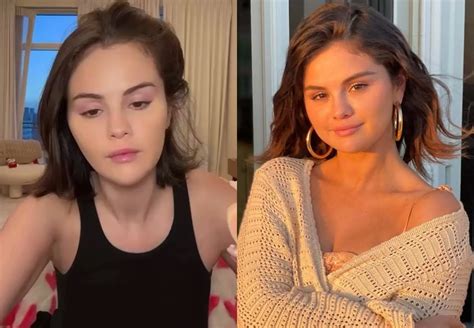 Lips Blown Off Selena Gomez S New Face Discussed Online MustHub