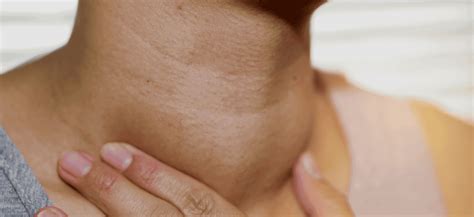 Thyroid Awareness Month Lalich Communications