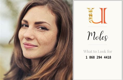 Moles What To Look For