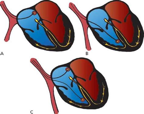 Conduction Blocks The Only Ekg Book 9th Ed