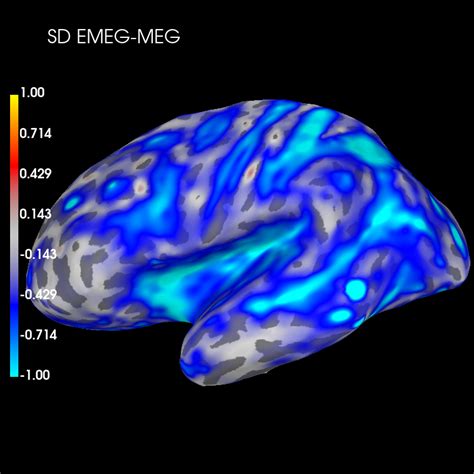 Compute Spatial Resolution Metrics To Compare Meg With Eegmeg — Mne 1