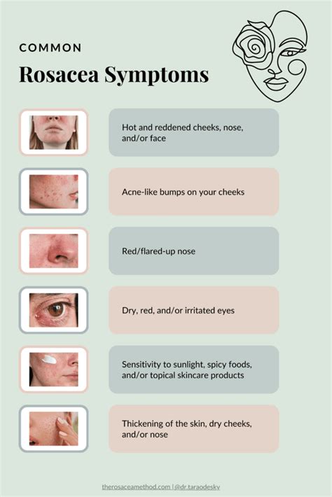 Top 8 Rosacea Triggers Avoid Flare Ups The Rosacea Method