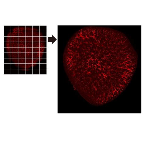 Keyence Life Sciences On Linkedin Keyence Fluorescence Microscopy Imagestitch