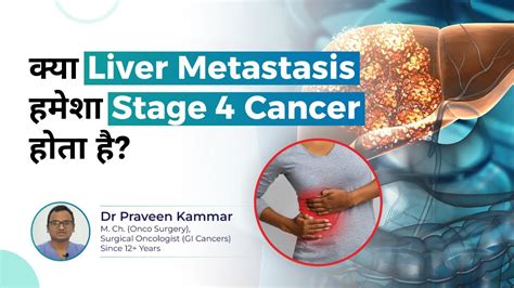Is Liver Metastasis Always Stage 4 Cancer Liver Cancer And Stage 4 Diagnosis Dr Praveen