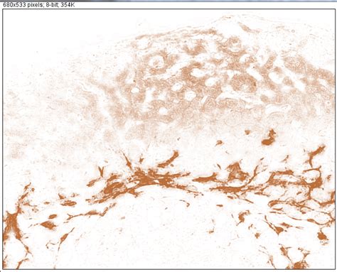 problem to measure adjusted threshold image analysis image sc forum
