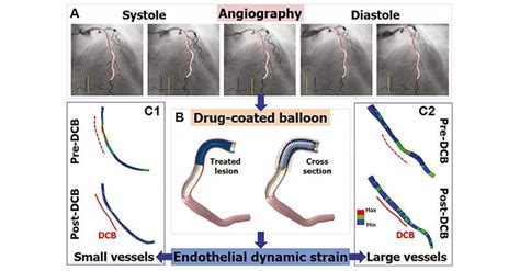Angiography Based Computational Modeling For In Vivo Assessment Of