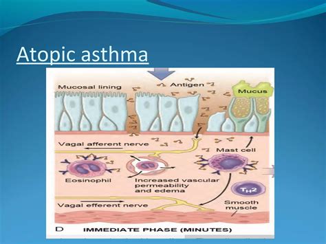 Pathogenesis Of Bronchial Asthma Ppt