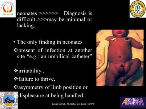 Septic Epiphysitis In Neonates And Infants Ppt