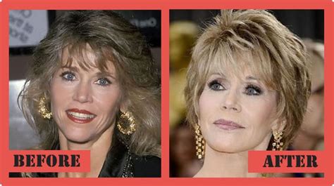 Jane Fonda Jane Fonda Plastic Surgery Plastic Surgery Celebrity