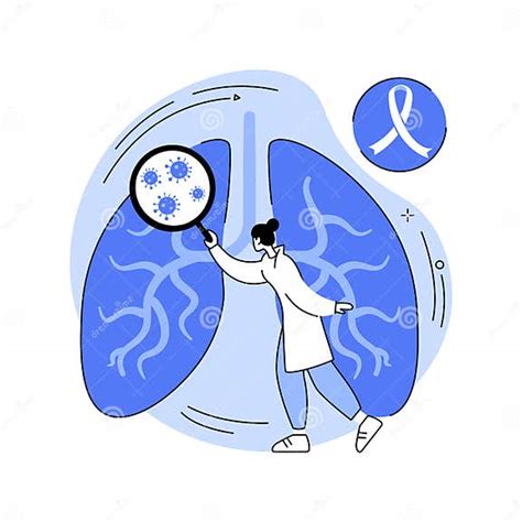 肺癌抽象概念矢量图插图 向量例证 插画 包括有 设计 养殖 现代 诊所 动画片 系数 经典 209306129