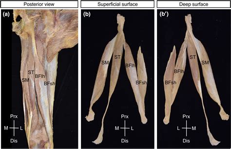 Semitendinosus Muscle Cadaver