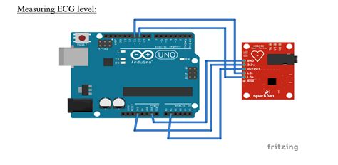 Non Invasive Glucose And ECG Levels Monitoring Arduino Smartech