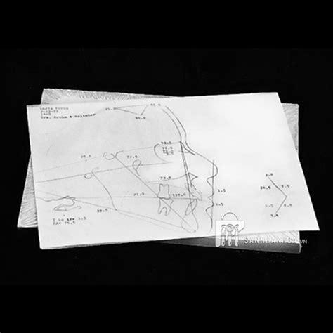 Mua Giấy Vẽ Đo Sọ Chuyên Dụng Ceph Tracing Paper ️ Vat đầy đủ