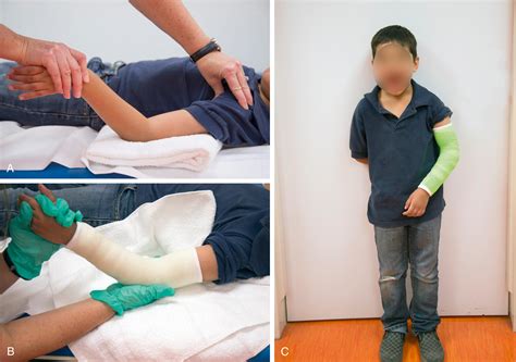 Disorders Of The Upper Extremity Clinical Tree