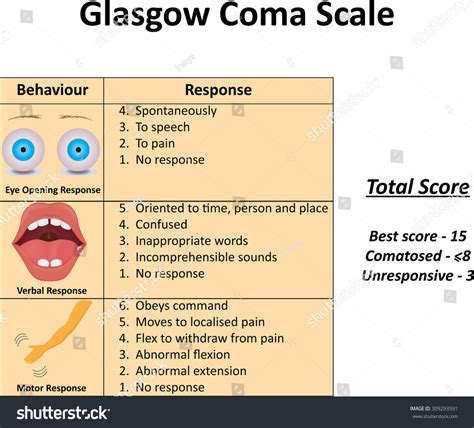 Glasgow Coma Scale Illustration De Stock 309293591 Shutterstock