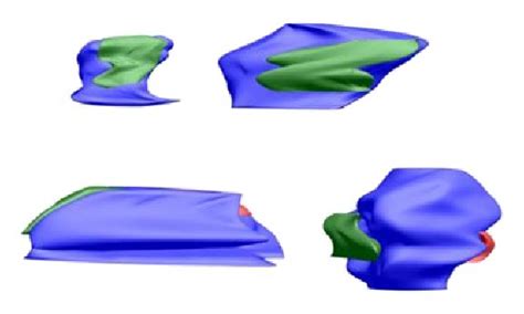 3d Reconstruction Of Single And Double Synapse Spines From Serial Download Scientific Diagram